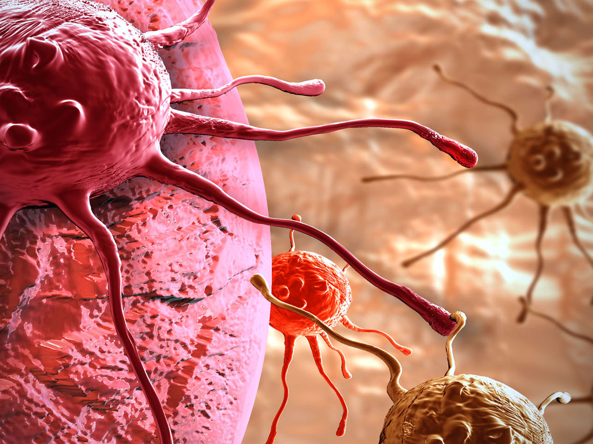 Tumore E Cancro Ecco Le Differenze Tumore E Cancro Ecco Le Differenze